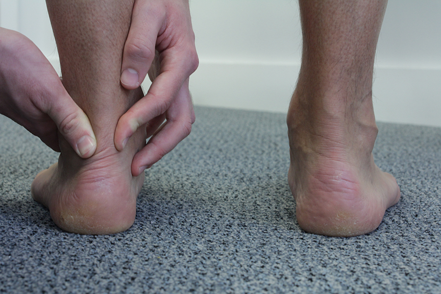 Pain On Outside Of Foot Below Ankle My XXX Hot Girl